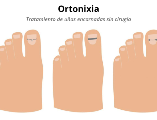 Talalgia - Dolor del talón